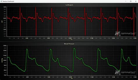 Ecg Signal Processing In Python With Lightningchart
