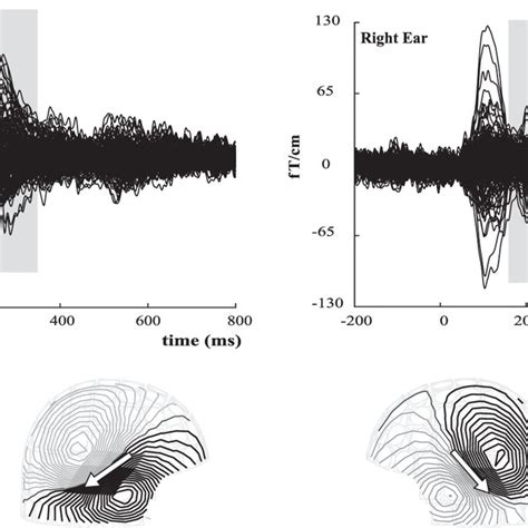 Butterfly Plot Of Signals Recorded By Gradiometer Sensors To Left And Download Scientific