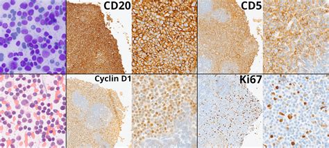 The Sydney System For Reporting Cancer Cytopathology Facebook