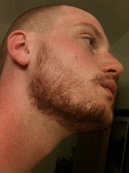 Advice For A Patchy Beard Week Update Page Beard Board