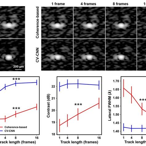 Phase Aberration Correction Performed On Simulated Microbubble Flows Download Scientific