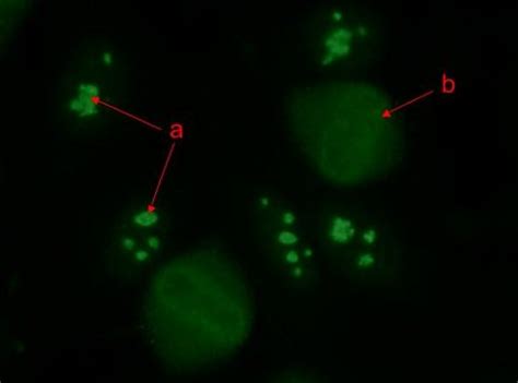 Immunology Labce Part 1 Flashcards Quizlet