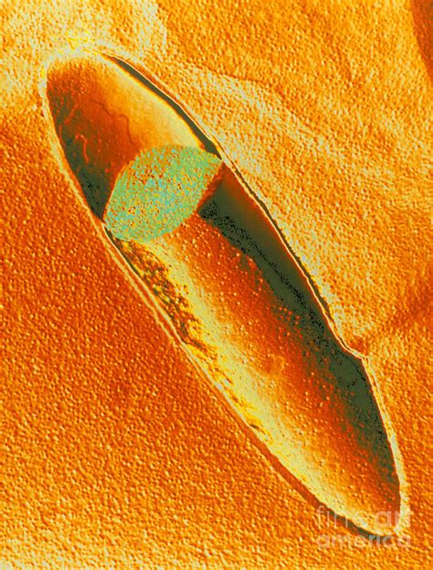 Lactobacillus Bulgaricus Photograph By Scimat Fine Art America