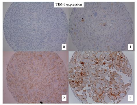 Stained Tissue Microarray Tma Cores Representative Micrographs Of