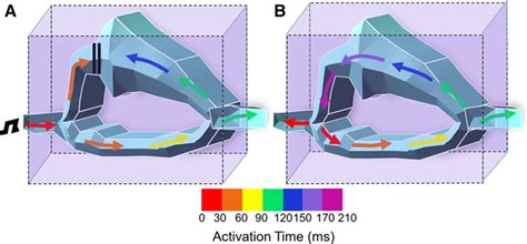 Formation Of Functional Conduction Block During The Onset Of Reentrant Ventricular Tachycardia