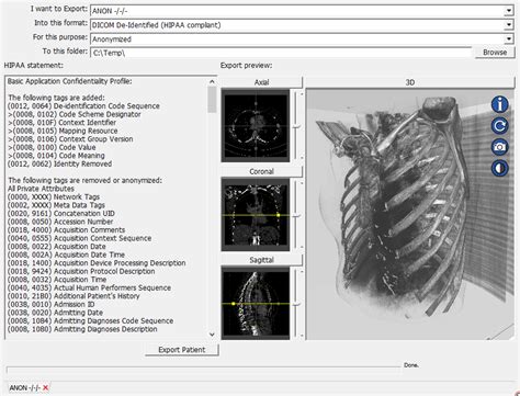 Can Anyone Help Me Converting Compressed Dicom File Into Uncompressed Dicom Files Researchgate