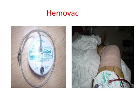Ppt Sterile Dressings Powerpoint Presentation Free Download Id943302
