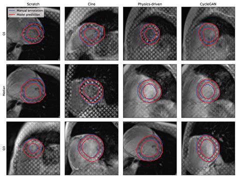 Bioengineering Free Full Text Myocardial Segmentation Of Tagged Magnetic Resonance Images