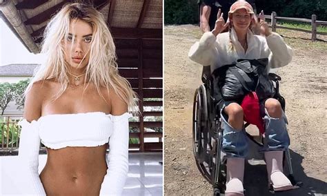 Aussie Model Sahara Ray Opens Up About Health Condition That Left Her