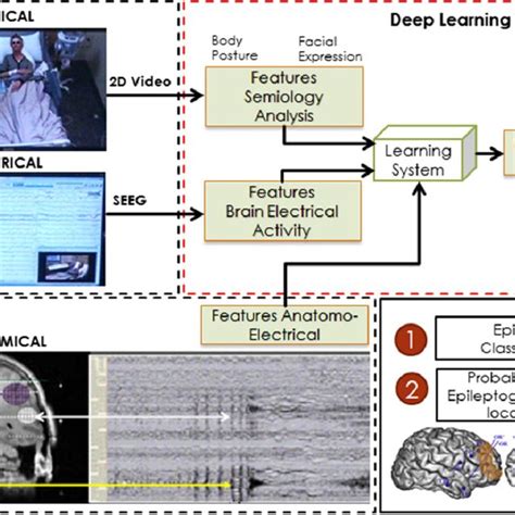 Asymmetric Tonic Posturing In Upper Limbs Image Adapted From Mcgonigal
