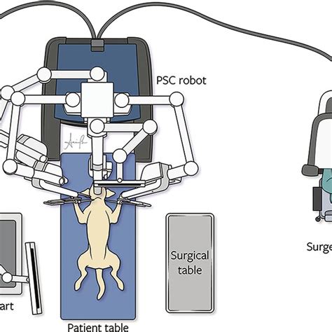 Diagram Of Port Placement For Robotic Cholecystectomy Port 1 12 Mm Download Scientific