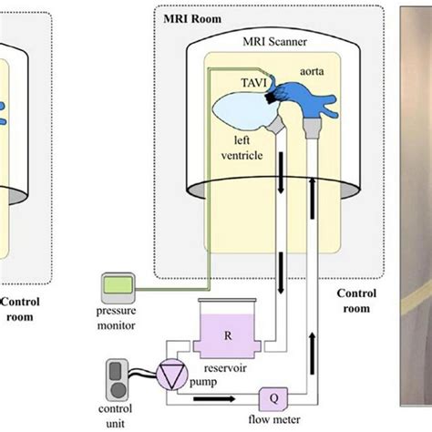 Schematic Representation Of The Pulsatile Flow Setup Left And Download Scientific Diagram