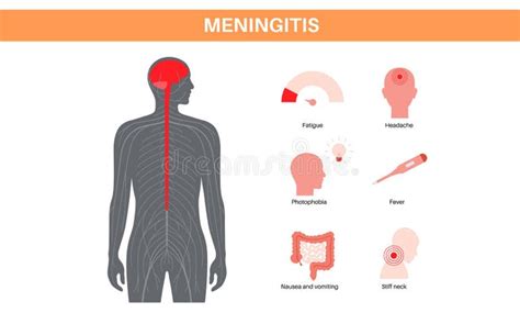 Meningitis Medical Poster Stock Vector Illustration Of Antibiotics