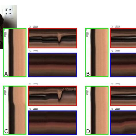 Figure E Illustration Of Our Motion Magnification Procedure As In