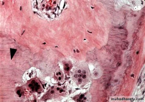 Dentin Pptx Dr Duran Muhadharaty