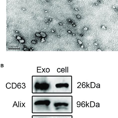 Characterization Of Microglia Derived Exosomes A Transmission