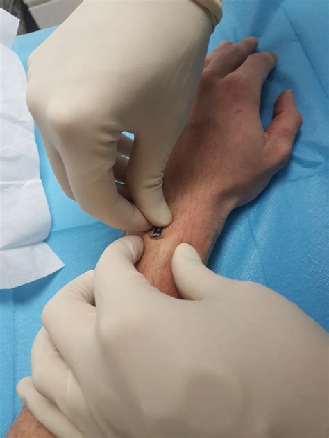 Install Videos And Pictures 🩸 Page 14 Lounge Dangerous Things Forum