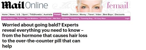 Am I Going Bald Everything You Need To Know About Hair Loss Male Pattern Baldness