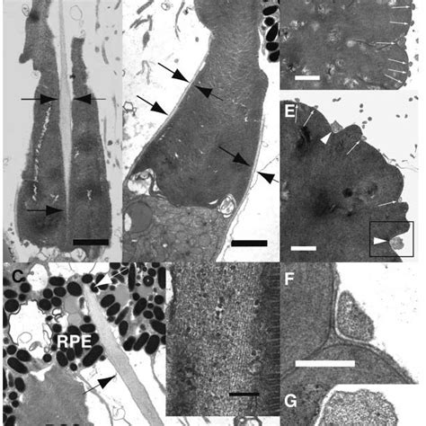 Effect Of 11 Cis Retinal On Cone Opsin Distribution Download Scientific Diagram