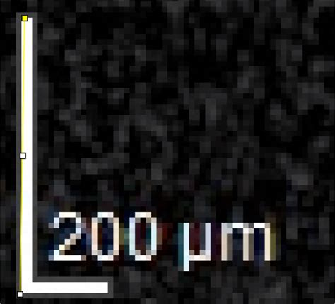 A Problem With The Image Scale Bar Rimagej A Problem With The Image Scale Bar Rimagej