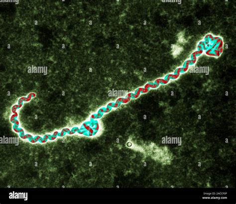 Leptospira Bacterium Coloured Transmission Electron Micrograph Tem This Bacterium Causes