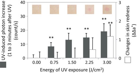Comparison Of Methods To Evaluate Skin Damage After UV Exposure The Download Scientific