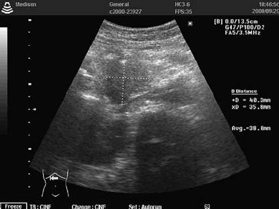Original Bpp Ultrasound Image Download Scientific Diagram