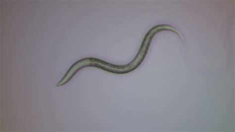 96 Caenorhabditis Elegans Stock Videos Footage And 4k Video Clips