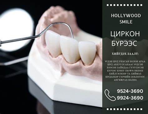Циркон бүрээс гэж юу вэ Dental Zone Шүдний эмнэлэг Facebook