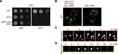 Figures And Data In The Yeast Endocytic Early Sorting Compartment Exists As An Independent Sub