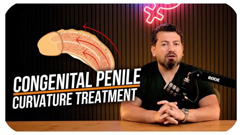 Congenital Penile Curvature Treatment Explained Youtube