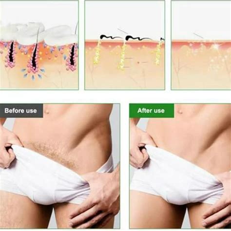 How To Remove Hair From Private Parts Of Woman Permanently