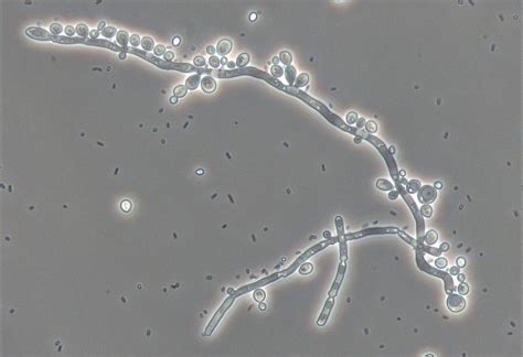 Candida Albicans Microscopic