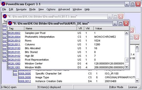 Create Dicomdir From Dicom Files Viewer