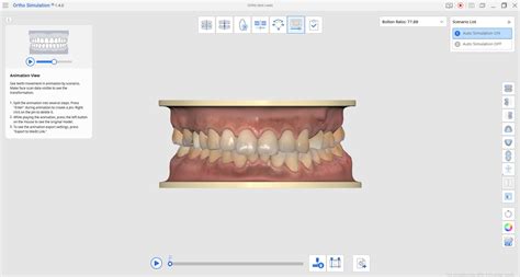 📖 Workflow Animation View Medit Help Center