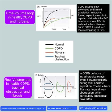 ⭕ Restrictive Vs Obstructive Lung Medical Education