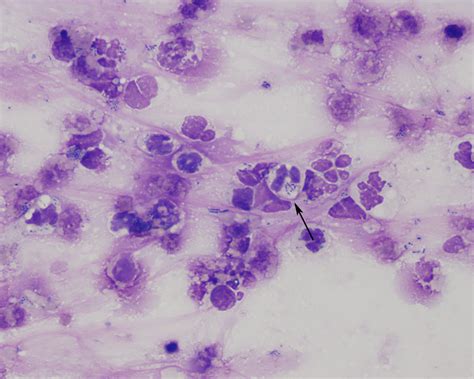 Rhodococcus Archives Eclinpath