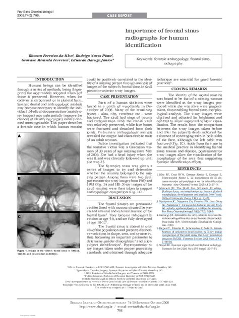 Pdf Importance Of Frontal Sinus Radiographs For Human Identification
