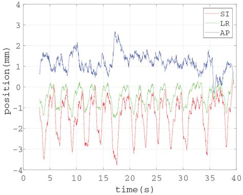 An Example Of Lung Tumor Motion Trajectory Of A Patient Measured With Download Scientific