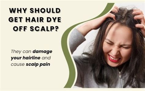 How To Get Hair Dye Off Scalp Detailed Instructions