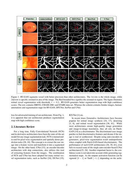 Rv Gan Retinal Vessel Segmentation From Fundus Images Using Multi