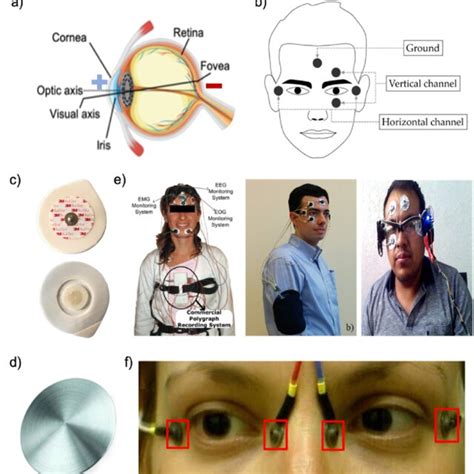Eog Detection Systems A An Anatomical Illustration Of The Eye Download Scientific Diagram