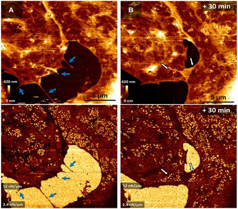 Tracking Fenestrae Dynamics In Live Murine Liver Sinusoidal Hepatology