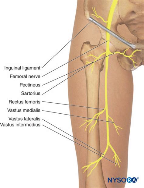 Femoral Nerve Block Landmarks And Nerve Stimulator Technique NYSORA