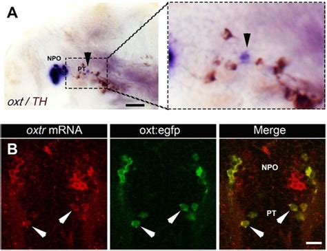 Figures And Data In Homeodomain Protein Otp Affects Developmental Neuropeptide Switching In