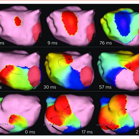 examples of complex activation patterns identified using charge density