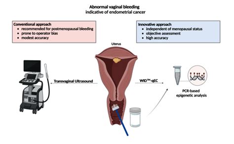 Eutops Institute New Molecular Test Proves Reliable For Early Detection Of Womb Cancer