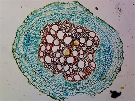 Angiosperm Root Dicot Showing General Structures Cross Section By Go