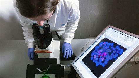 Survival Rate For Pancreatic Cancer Stage Age And More