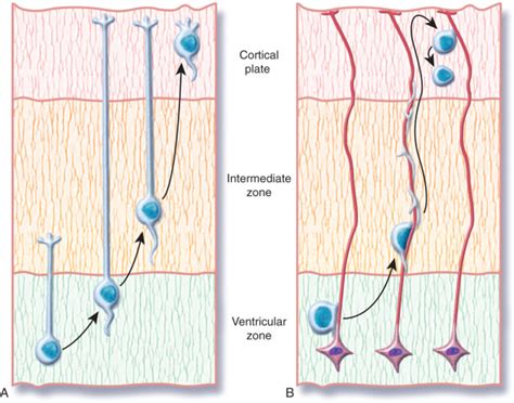 Neuronal Migration Neupsy Key